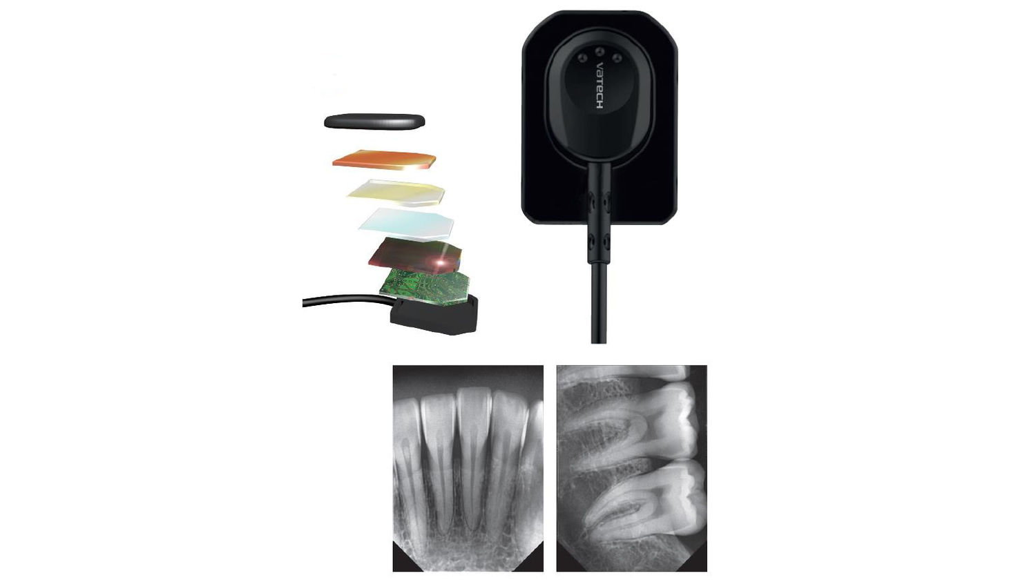 Ez Sensor | materieldentaire66.fr